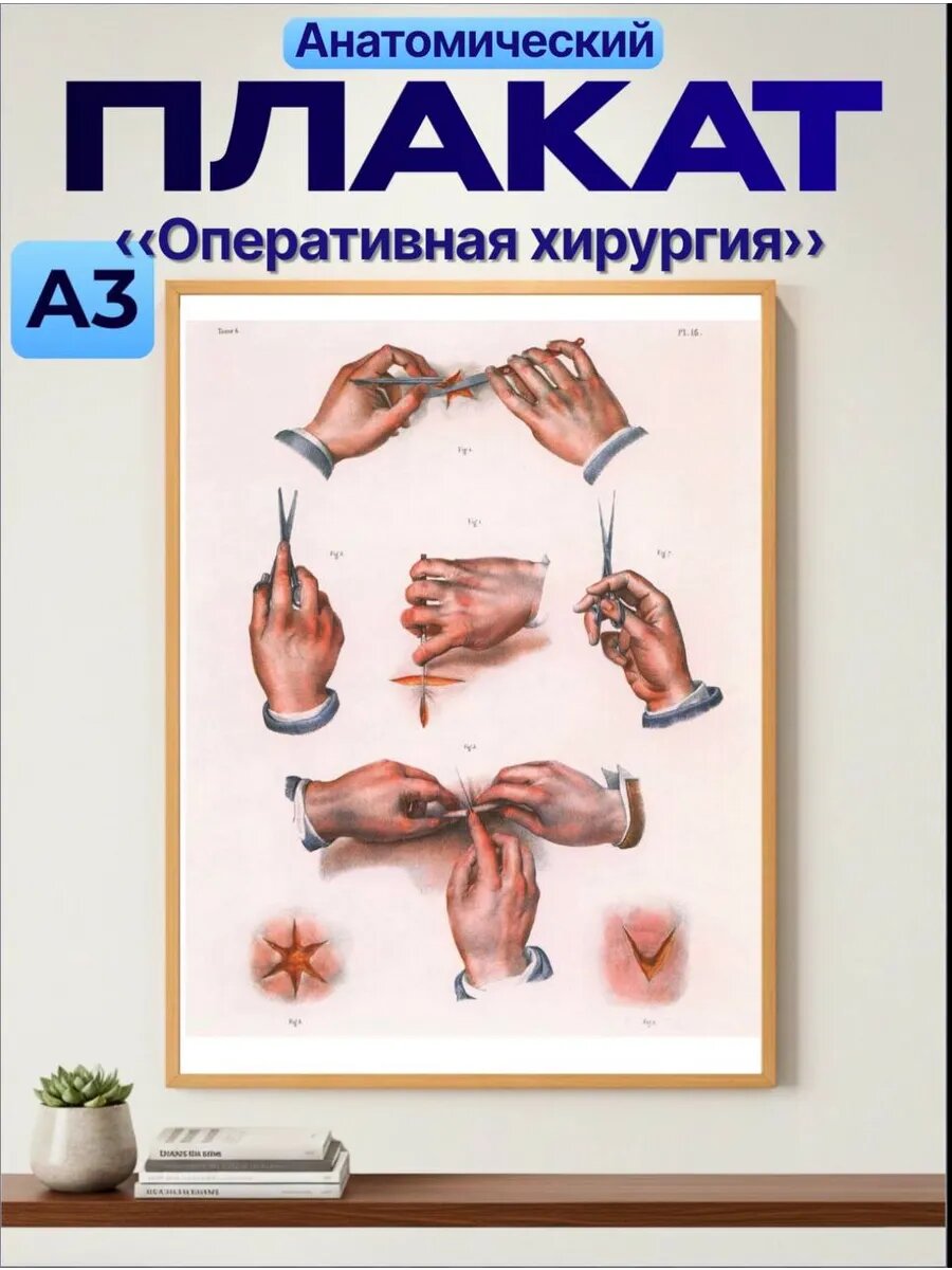Постер медицинский, скальпель, оперативная хирургия, А3 анатомия, хирургия