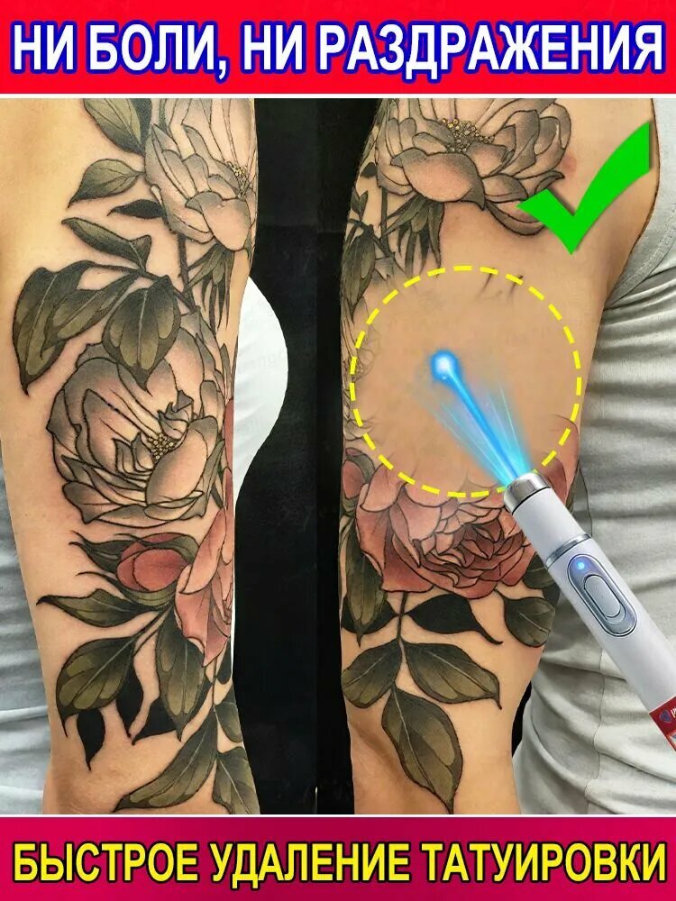 Лазерная ручка для удаления татуировок, постоянное удаление татуировок, быстрая и эффективная глубокая очистка, без боли, без побочных эффектов, без шрамов