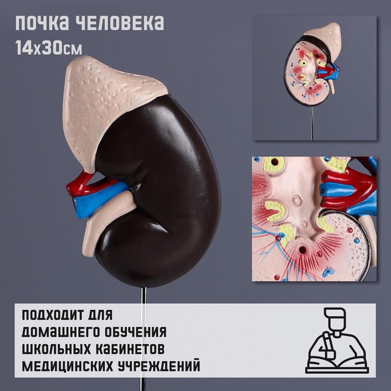 Анатомическая модель "Макет почки человека", пластик, 14 х 30 см