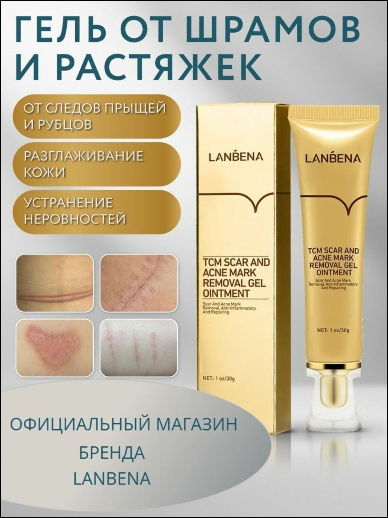 Инновационный гель LANBENA для лица, груди и живота, признанный бестселлер, эффективно корректирующий растяжки, постакне, шрамы, рубцы и пигментацию на теле