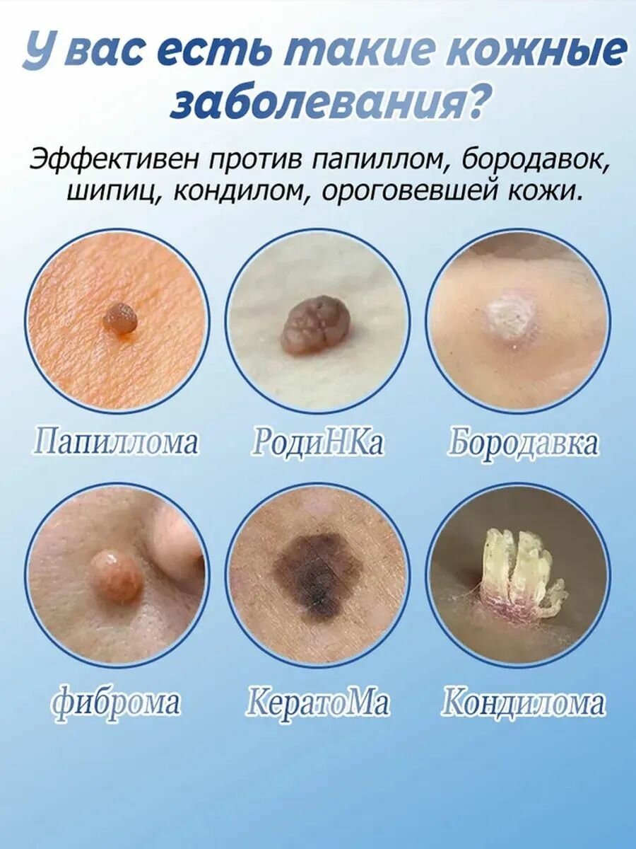 Средство для удаления кератом