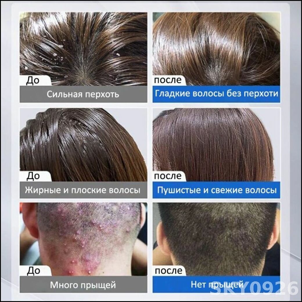 Шампунь для волос — фото 1