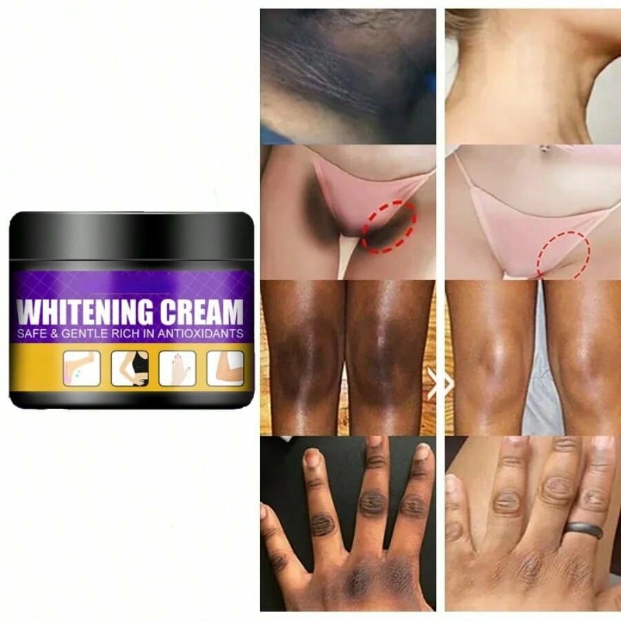 Отбеливание освежает цвет кожи, подмышки, колени, увлажняющий крем для локтей, увлажняющий и освежающий крем для темной кожи.