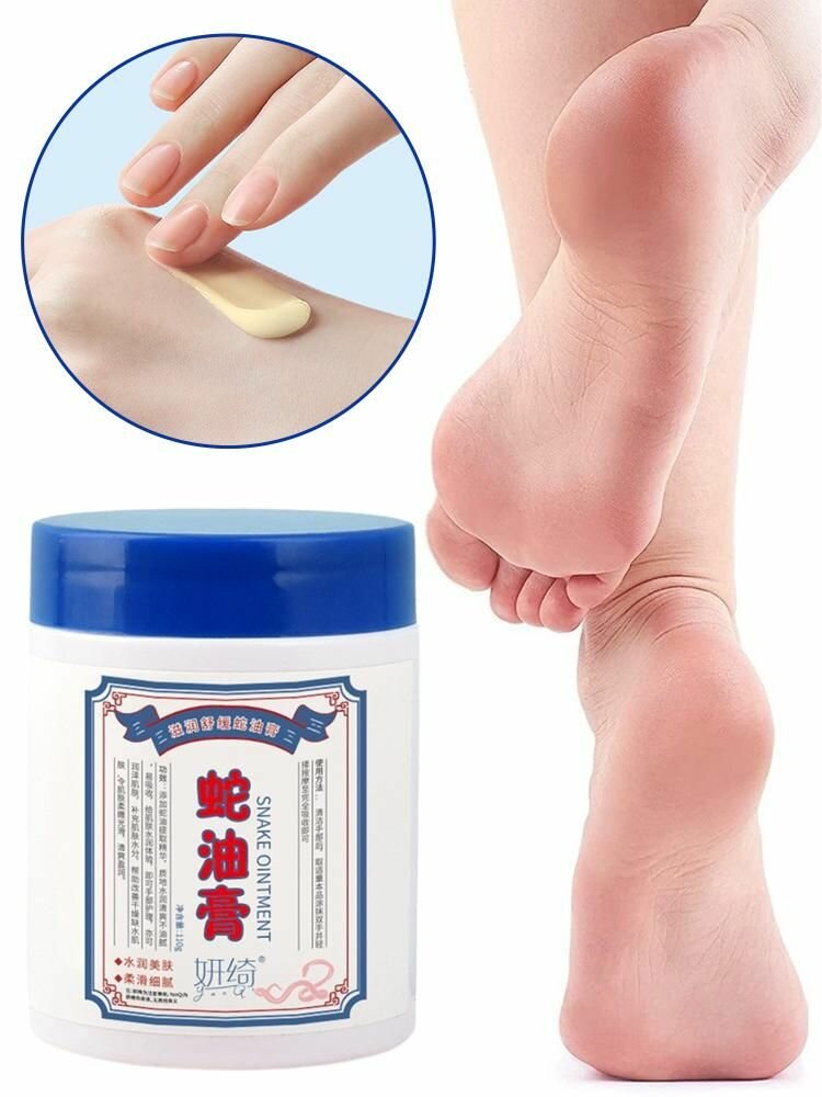 Крем-бальзам Змеиное масло от трещин на пятках и сухости рук, интенсивное увлажнение для женщин и мужчин