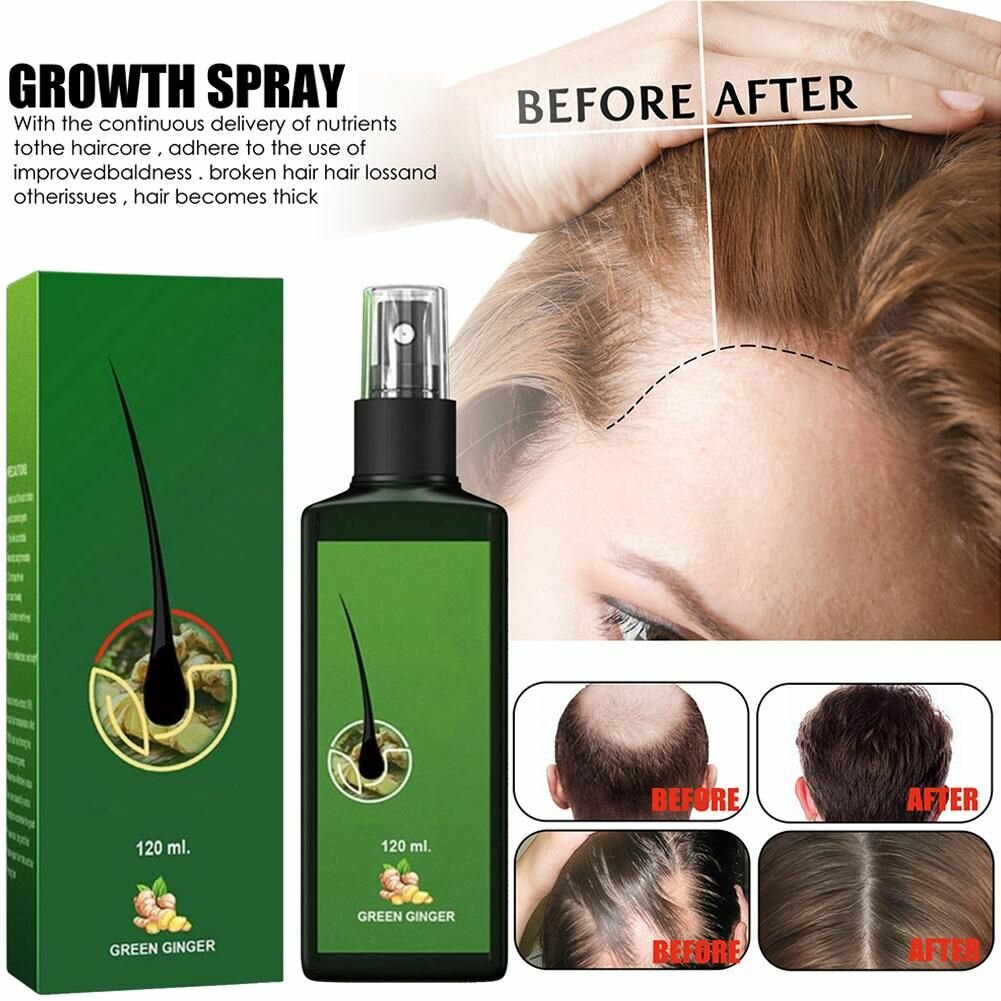 120 мл сыворотка для роста волос, Способствует здоровому росту волос