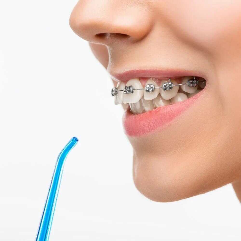 Ирригатор для зубов Xiaomi Soocas W3 PRO портативный, 4 насадки для полости рта,3 режима, всего 7 передач