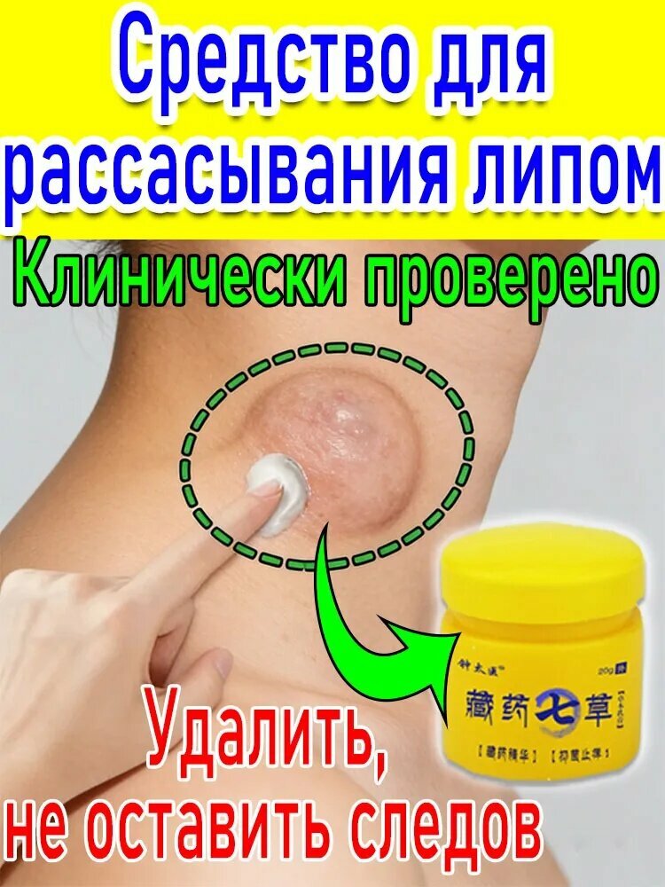 Мазь от липомы, Быстрое и безопасное удаление жировиков 20 г