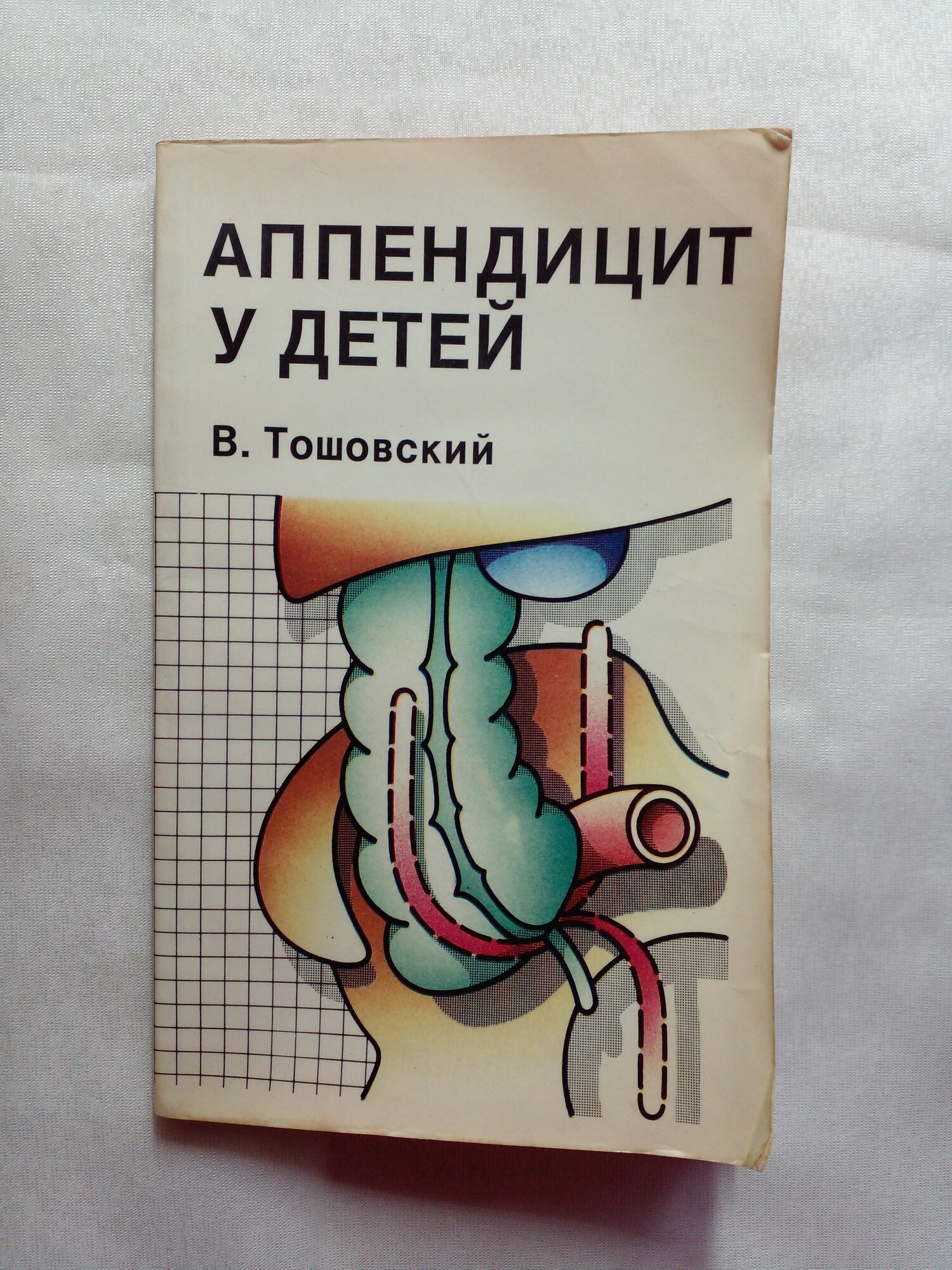 Аппендицит у детей. 1988год изд