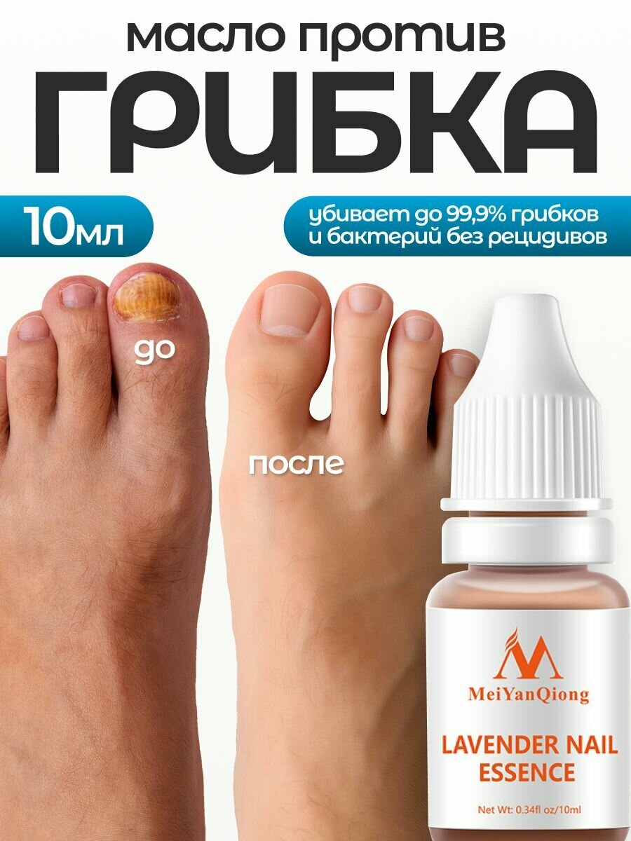 Масло для ногтей от грибка, средство для лечения грибка Nail Fungus, 10 мл, лечение онихолизиса