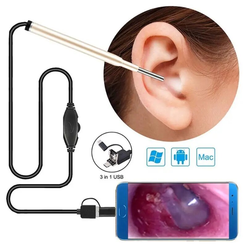 XGKHUT USB эндоскоп для ушей Golden