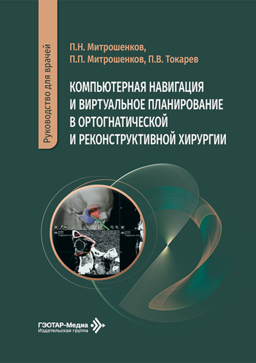 Компьютерная навигация и виртуальное планирование в ортогнатической и реконструктивной хирургии: руководство для врачей. Митрошенков П. Н, Митрошенков П. П, Токарев П. В.