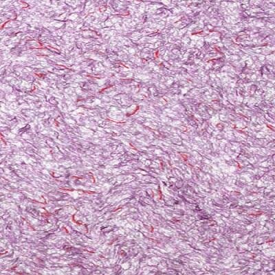 Жидкие Обои Bioplast 611 1 Пачка / Биопласт 611.
