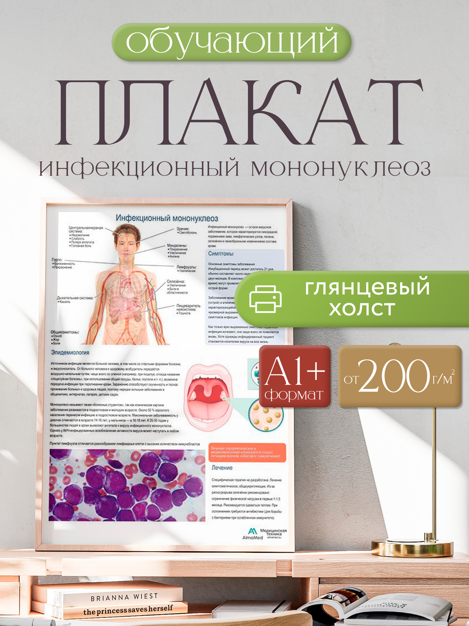 Инфекционный мононуклеоз медицинский плакат А1+, глянцевый холст от 200г/м2