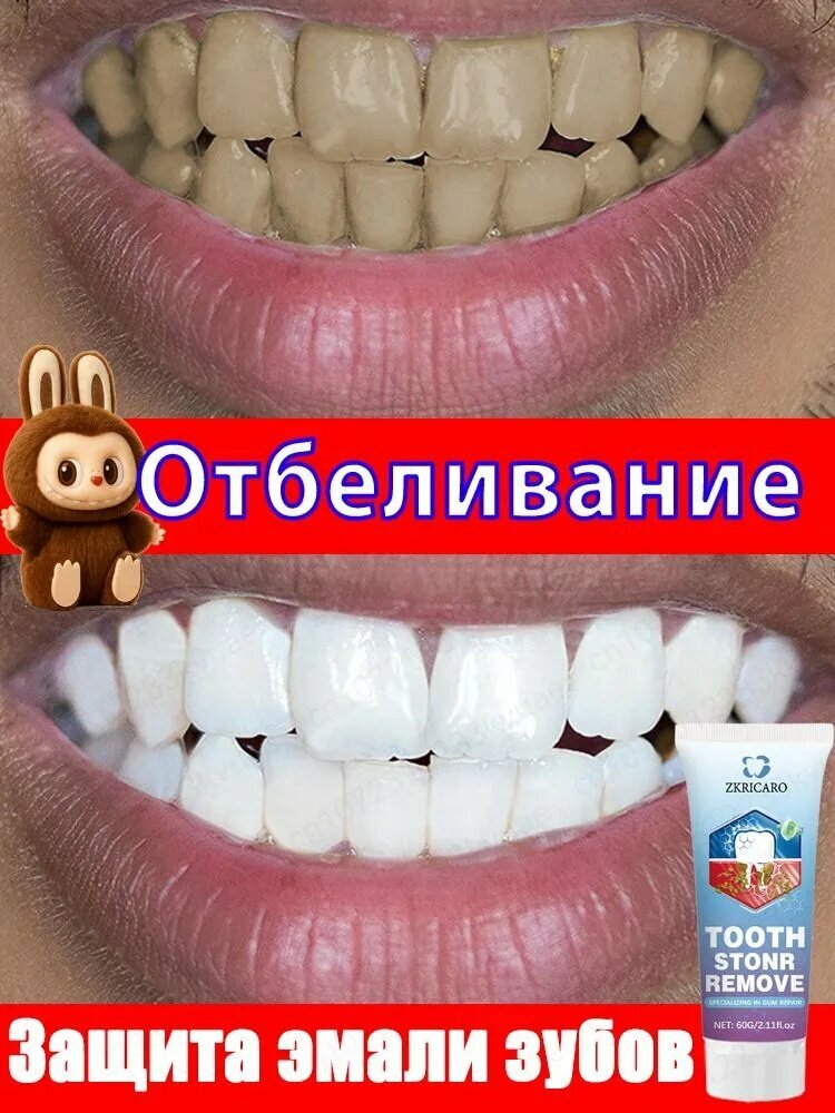 Инновационная Отбеливающая зубная паста, удаляет зубной камень, налет, кариес, для гигиены и ухода за полостью рта, укрепляет эмаль и десны, 60 г