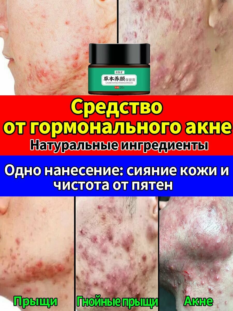 Мазь от прыщей, направленная на акне и угри, эффективно борется с воспалениями, прыщами и последствиями акне, подходит подросткам и проблемной коже, 20 г