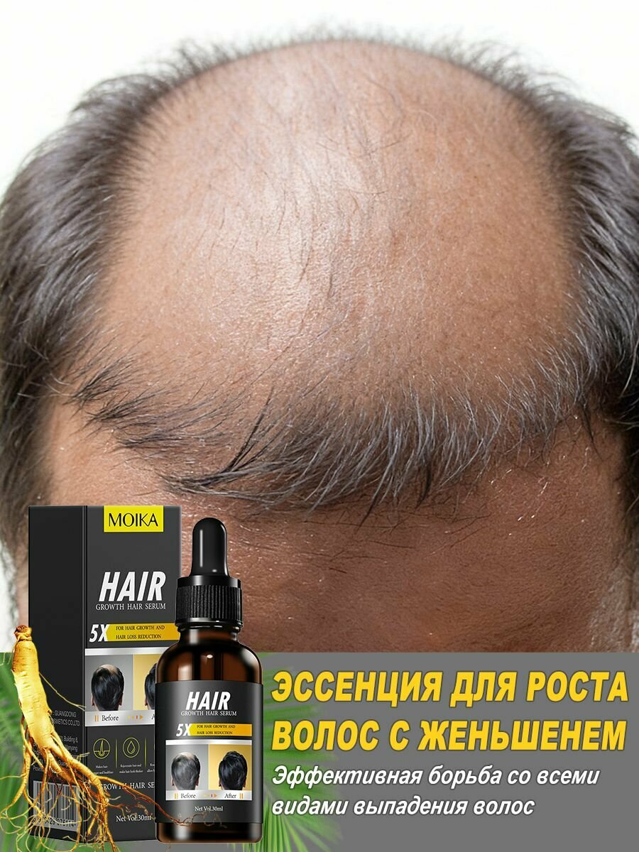 Сыворотка для роста волос, уменьшение выпадения и облысения, ускоренный рост, 30 мл