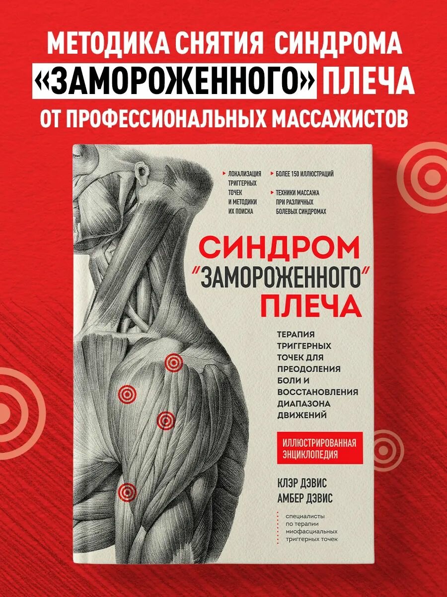 Медпроф Синдром замороженного плеча. Триггерные точки