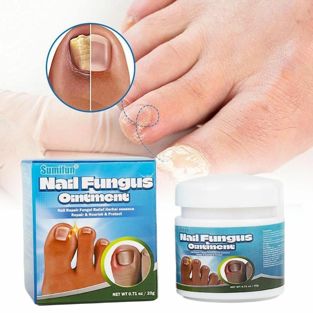 Лечебная мазь от грибка ногтей, восстанавливающий крем для укрепления и оздоровления ногтевой пластины