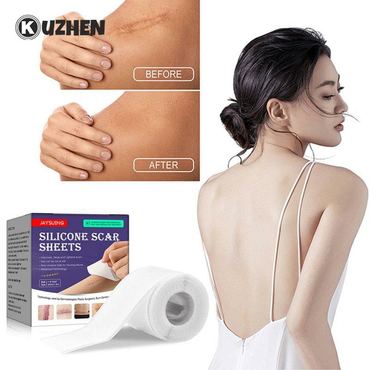 4*150 см силиконовые пластыри для лечения шрамов - удаление ожогов и прыщей и косметический уход за кожей