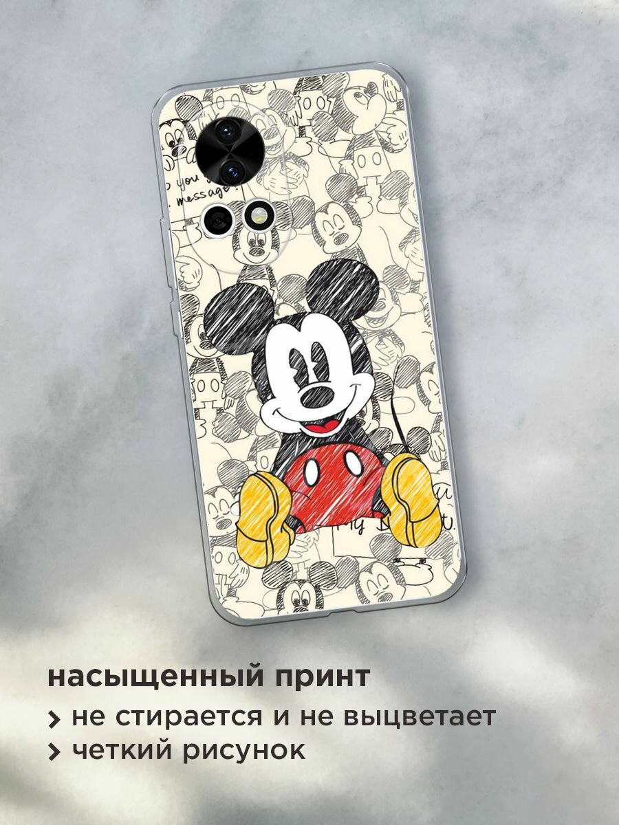 Чехол на Huawei Nova 12/Nova13 / Хуавей Нова 12/Нова 13 с принтом "Микки Маус" — фото 1