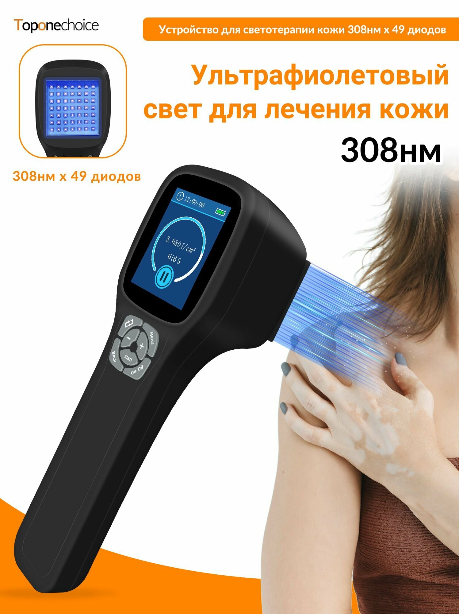 Toponechoice Ультрафиолетовый прибор 308 нм, бережный уход и поддержка здоровья кожи