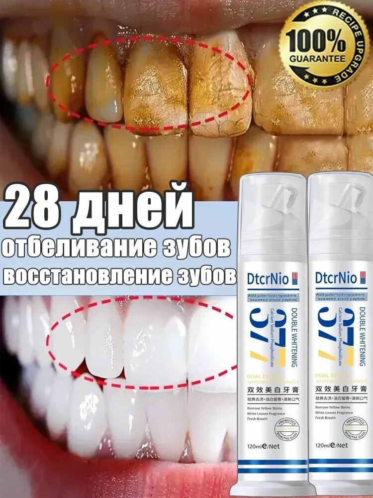 Мощная отбеливающая зубная паста, против зубного камня и налета от кофе и сигарет, против неприятного запаха изо рта, отбеливающая, для чувствительных зубов 120 г