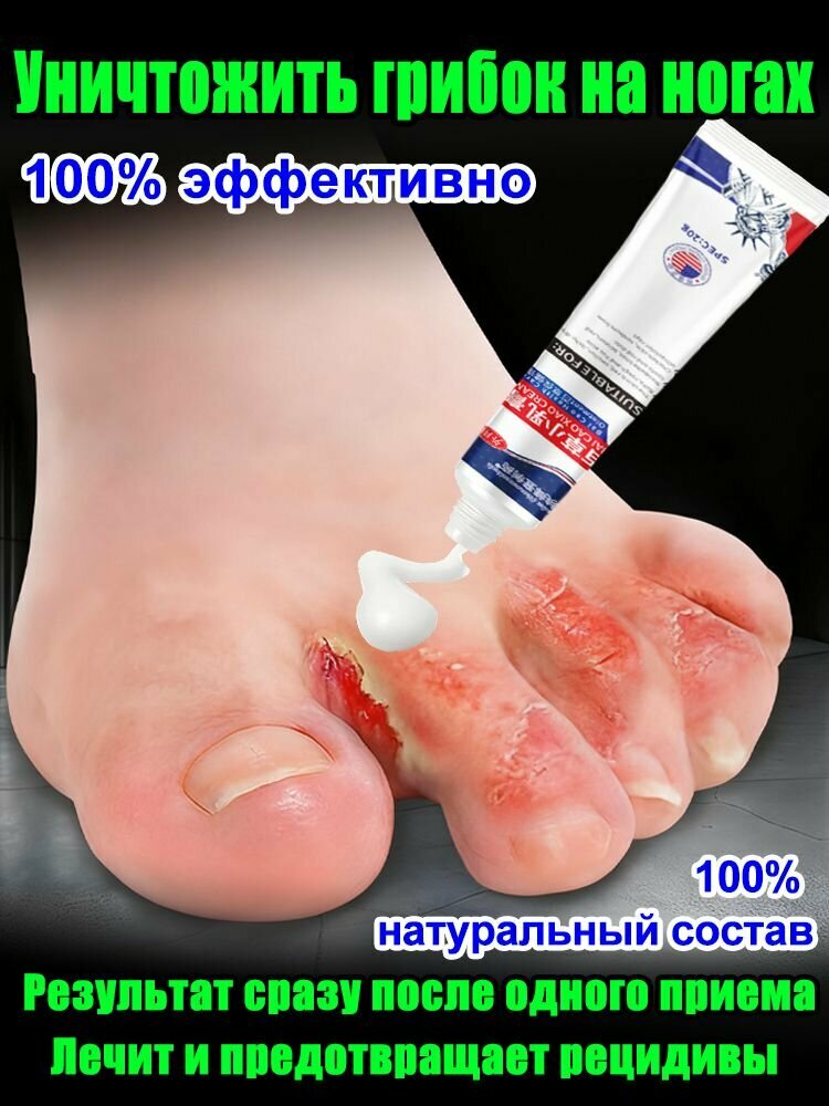 Крем от грибка стопы и шелушения между пальцев, для лечения и профилактики, 20 г
