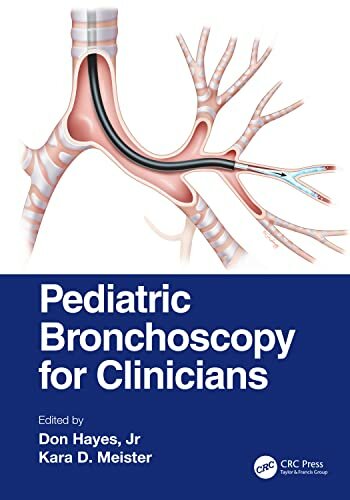 Pediatric Bronchoscopy for Clinicians Reprinted books