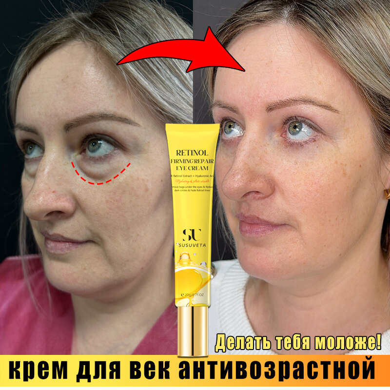 Крем для век антивозрастной / Крем для кожи вокруг глаз против мешков под глазами и морщин, устранение темных кругов, уменьшение морщин и восстановление эластичности, глубокое увлажнение.