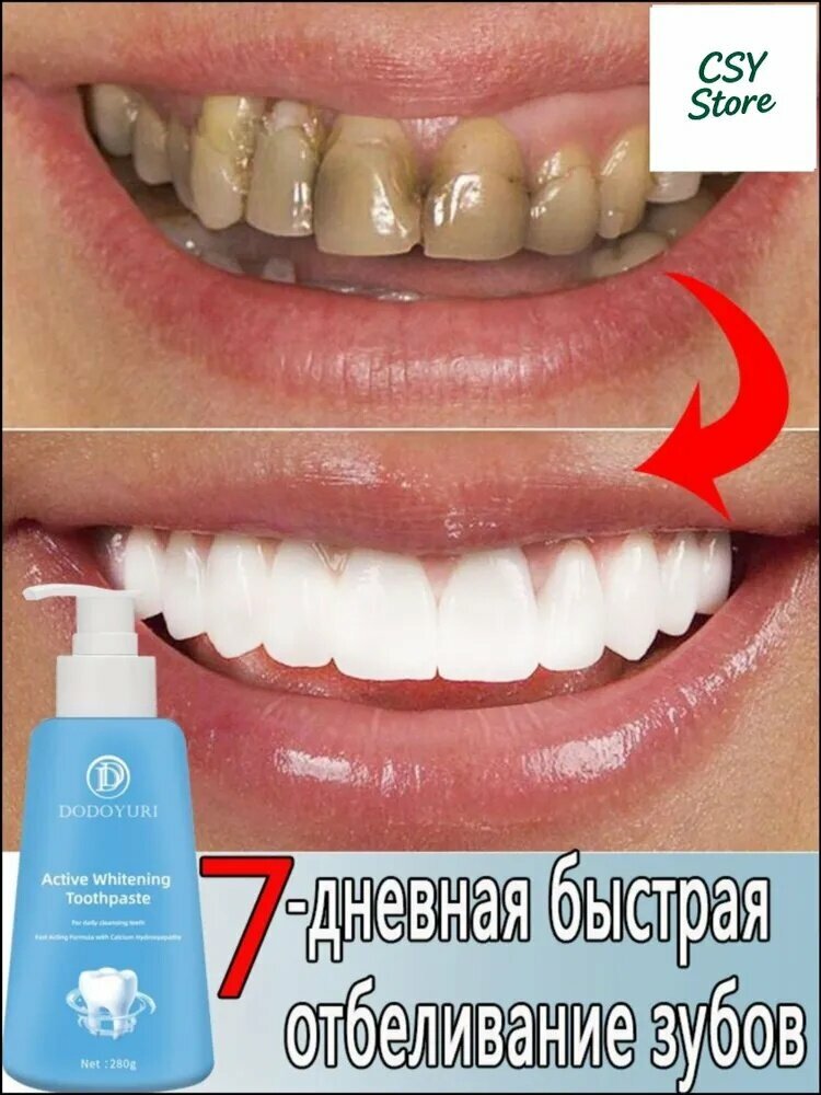 Бестселлер для гигиены зубов