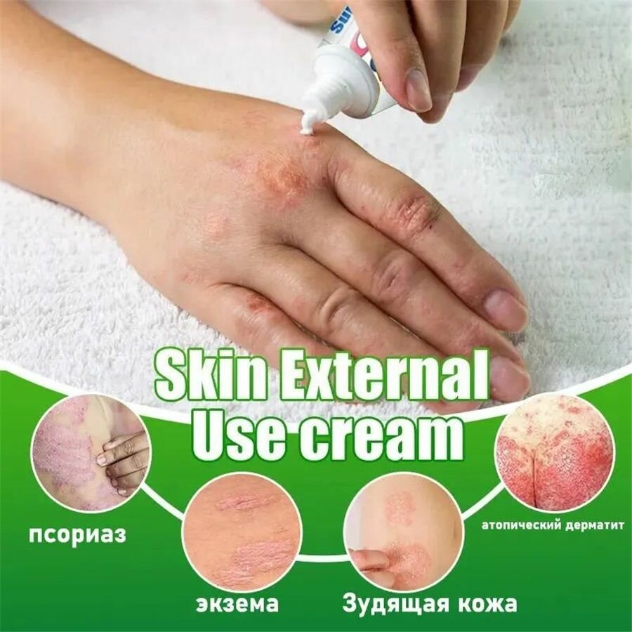 2 шт*20 г Sumifun Антибактериальная мазь Крем для ухода за кожей при псориазе, 20 г, экземе и герпесе, акне, ожогах, порезах, от прыщей на лице, укусов насекомых.