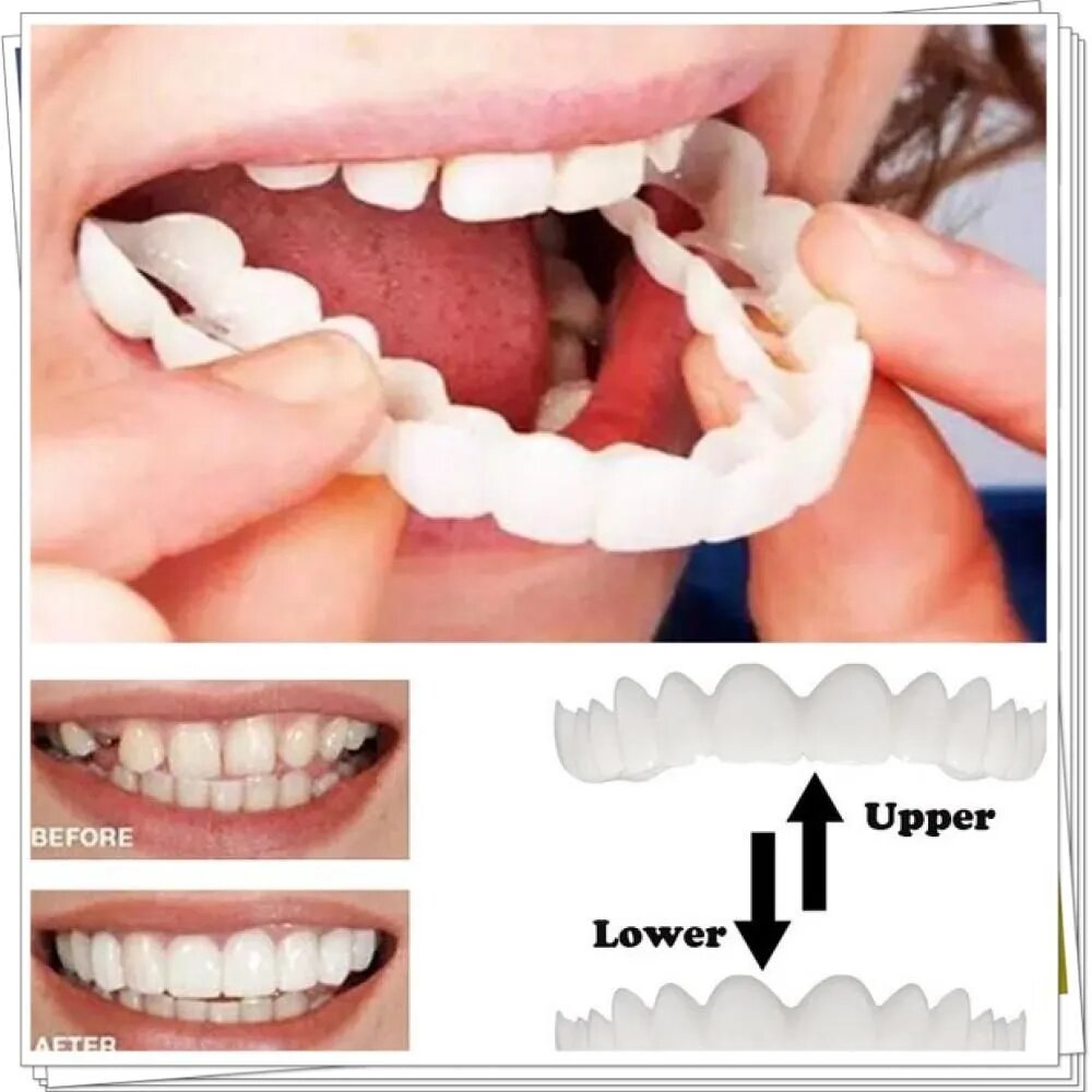 Зубы зубной протез