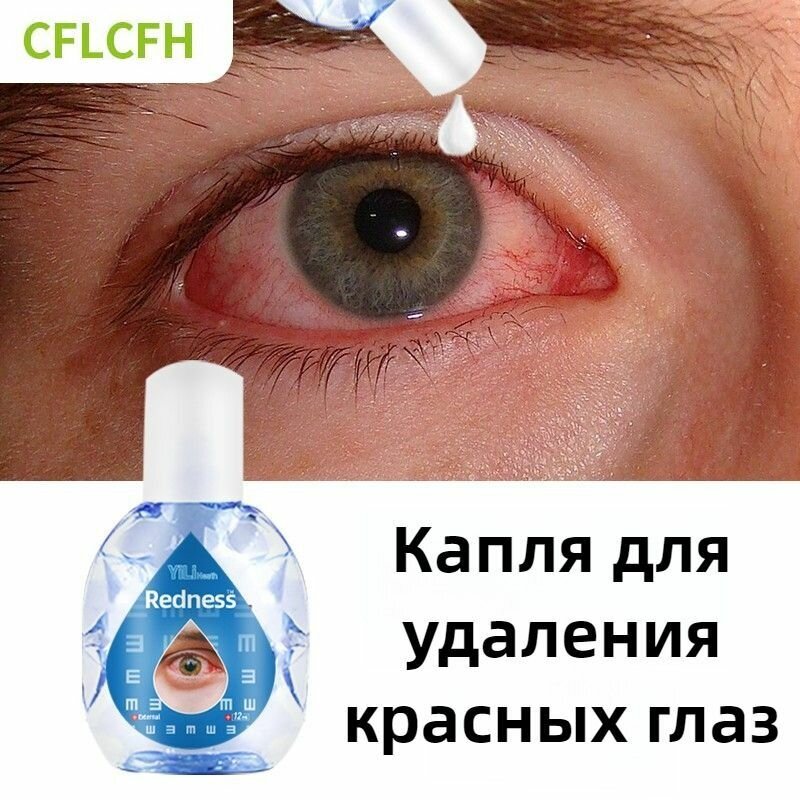 Капли для глаз увлажняющие от покраснения, Снимает сухость, зуд, покраснение и усталость глаз