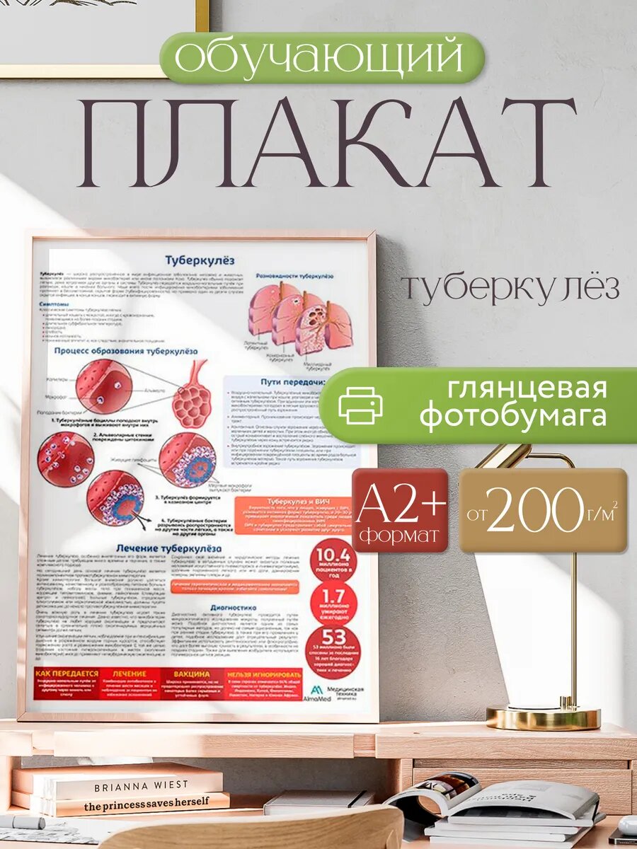 Туберкулёз медицинский плакат, глянцевая фотобумага от 200 г/кв. м, размер A2+