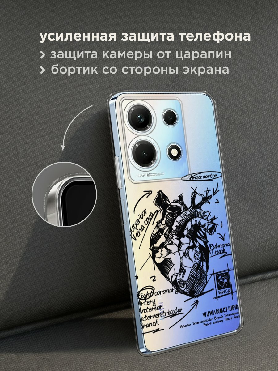 Чехол на Infinix Note 30 4G / Инфиникс Нот 30 4G с принтом "Анатомическое сердце 2", прозрачный — фото 1