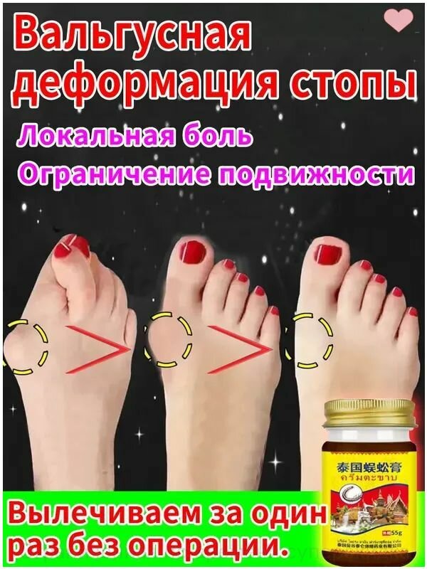 Премиальный крем из Таиланда для шишки на стопе для ног от шишки уход за стопами