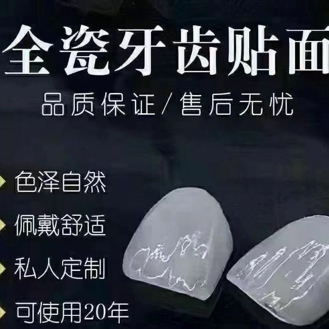 Отбеливающие полные керамические виниры, ультратонкие виниры для зубов, стиль знаменитостей TikTok, полные керамические виниры для зубов, индивидуальный заказ