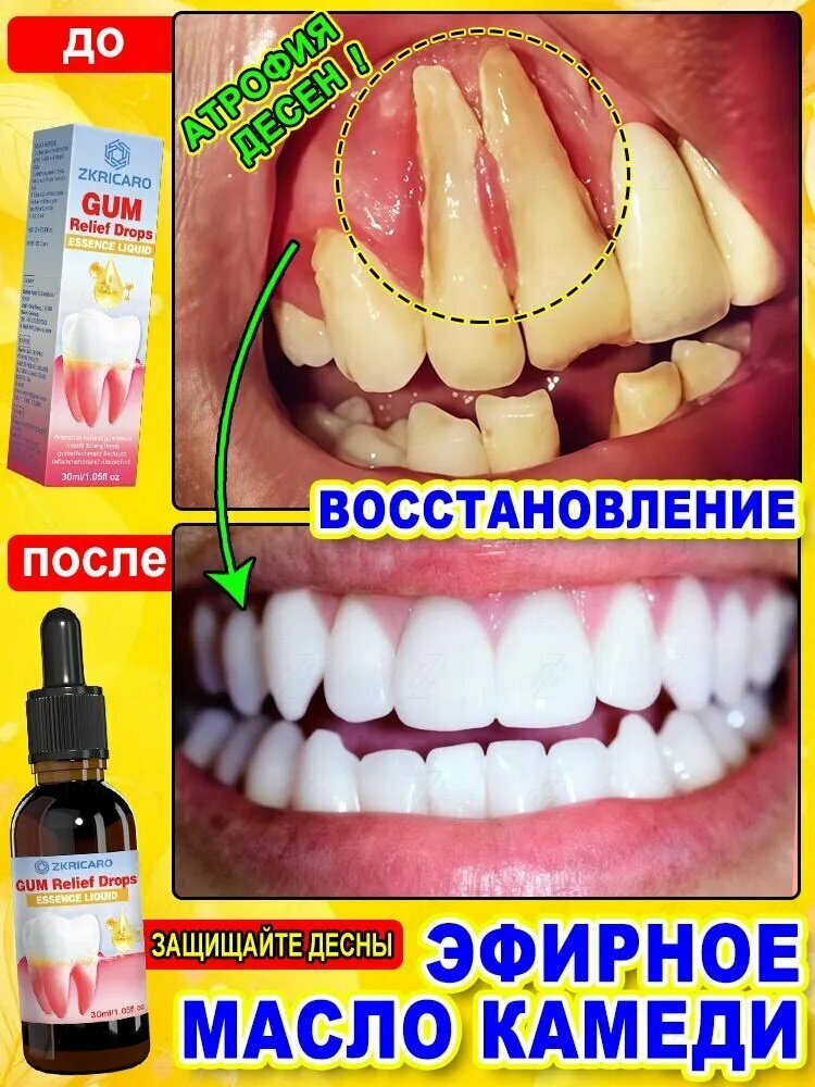 Эфирное масло для ухода за полостью рта на растительной основе, антибактериальное, защищает десны, снимает воспаление, подходит для людей с атрофией десен и чувствительными зубами.10 бутылок