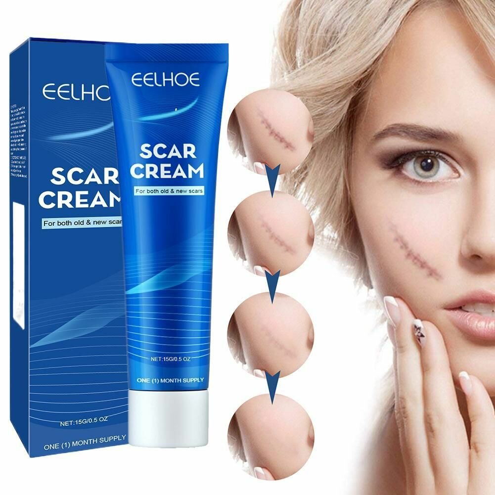 Крем от шрамов и рубцов, гель от прыщей на лице, мазь против ожогов и пигментных пятен и теле, средство от постакне15r