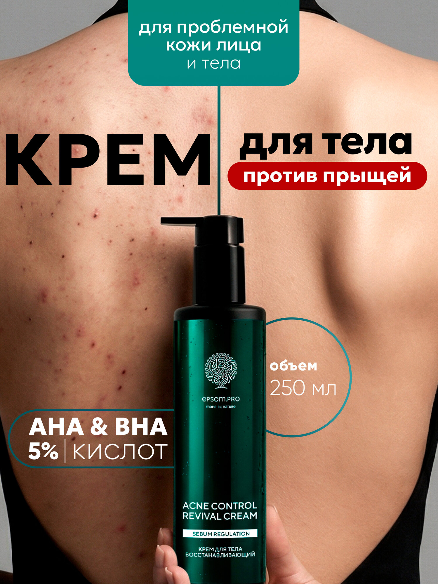 Крем ACNE CONTROL против акне и прыщей 250 мл с AHA и BHA кислотами