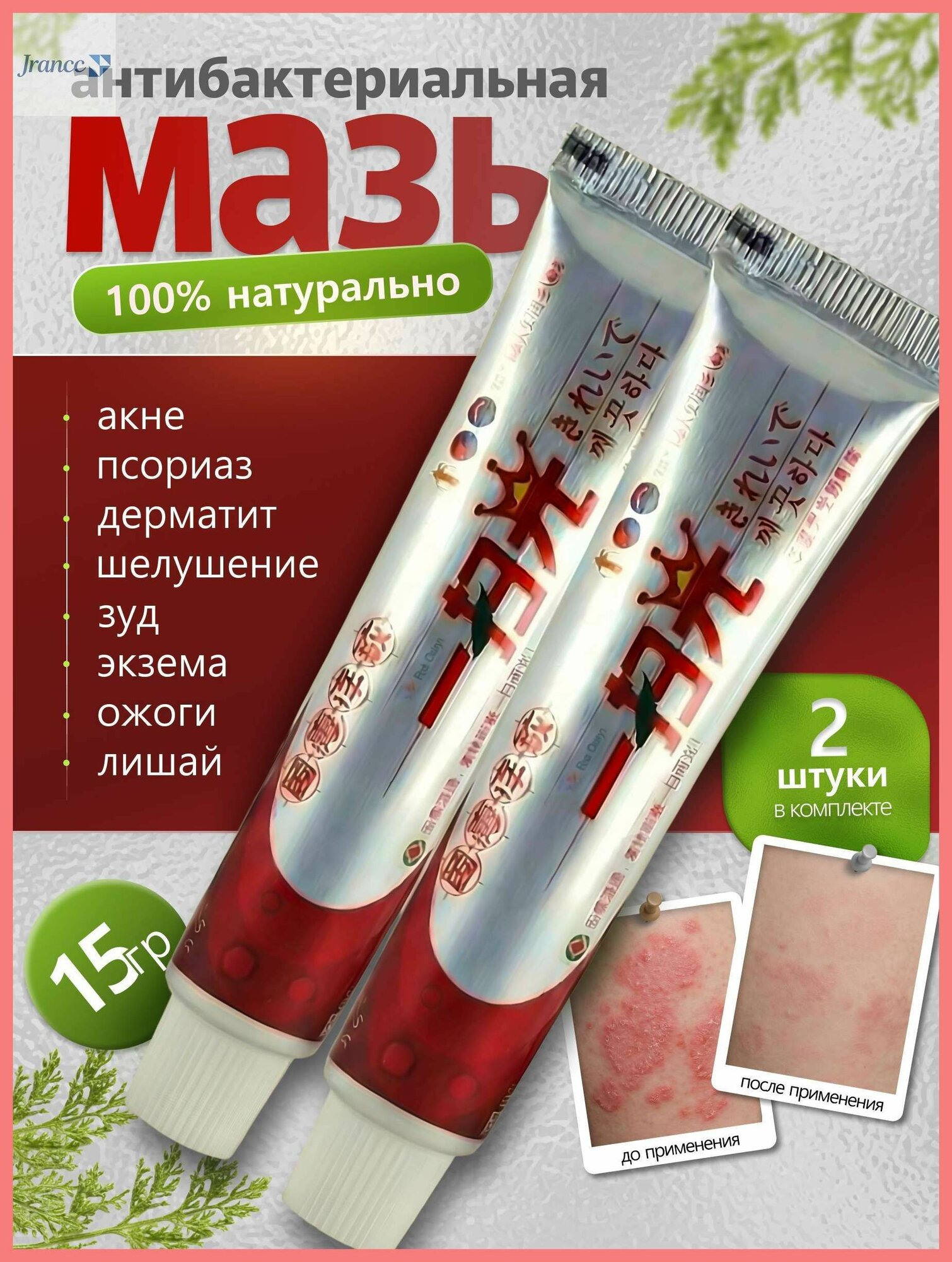 Китайская чудо мазь от прыщей, псориаза, экземы, дерматита, лишая, акне / Крем от псориаза китайский 15г*2