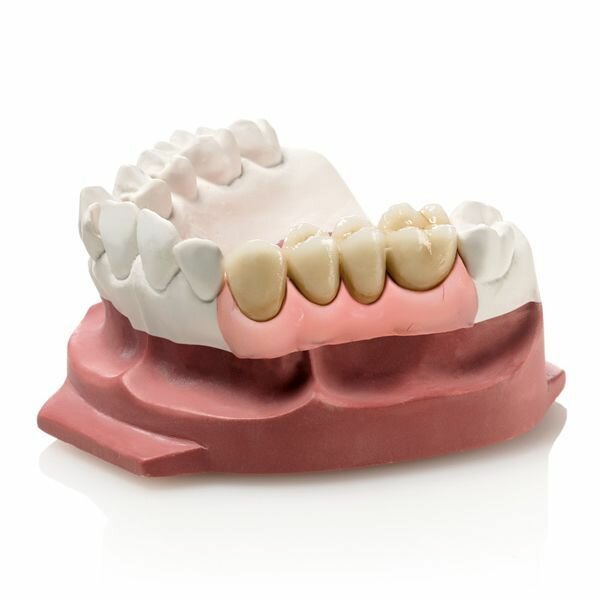 Десневая маска Гингифаст - Gingifast Elastic — фото 1