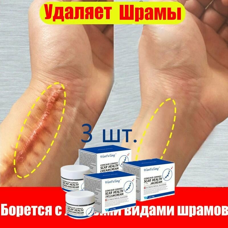 3 шт. kрем для удаления шрамов, Устранение растяжек 30г против рубцов, шрамов, стрии, растяжек и ожогов