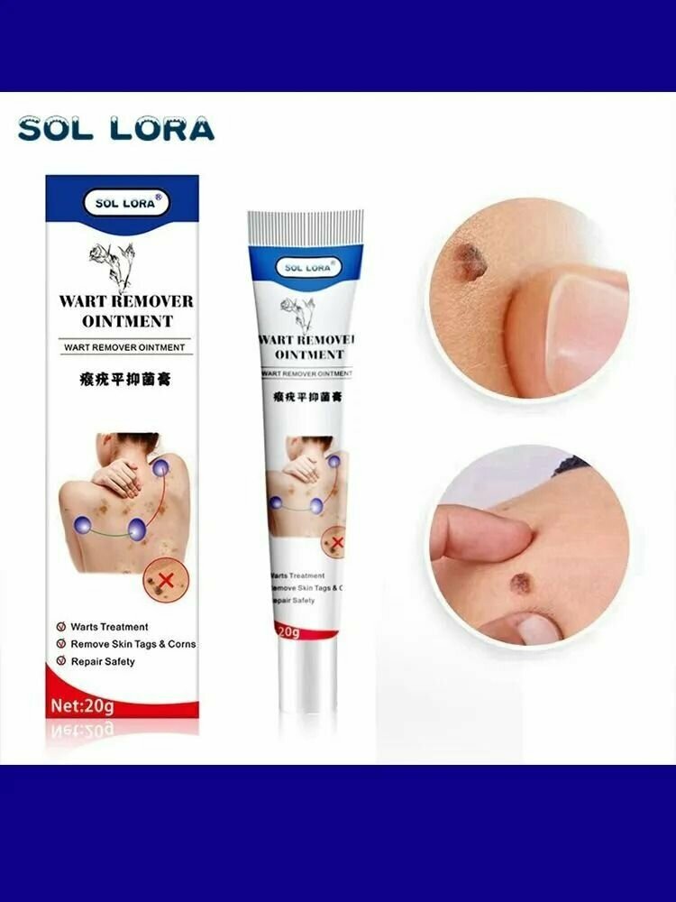 Мазь от бородавок, против генитальных бородавок, папиллом, ороговевшей кожи, мазь от прыщей, 20 г