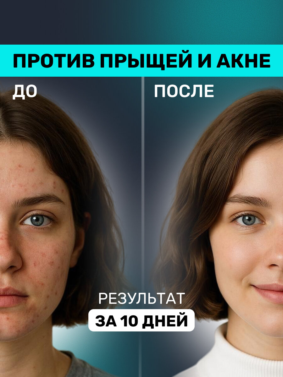 Крем от прыщей, жирного блеска и черных точек с ниацинамидом. Увлажняющий, 40 мл
