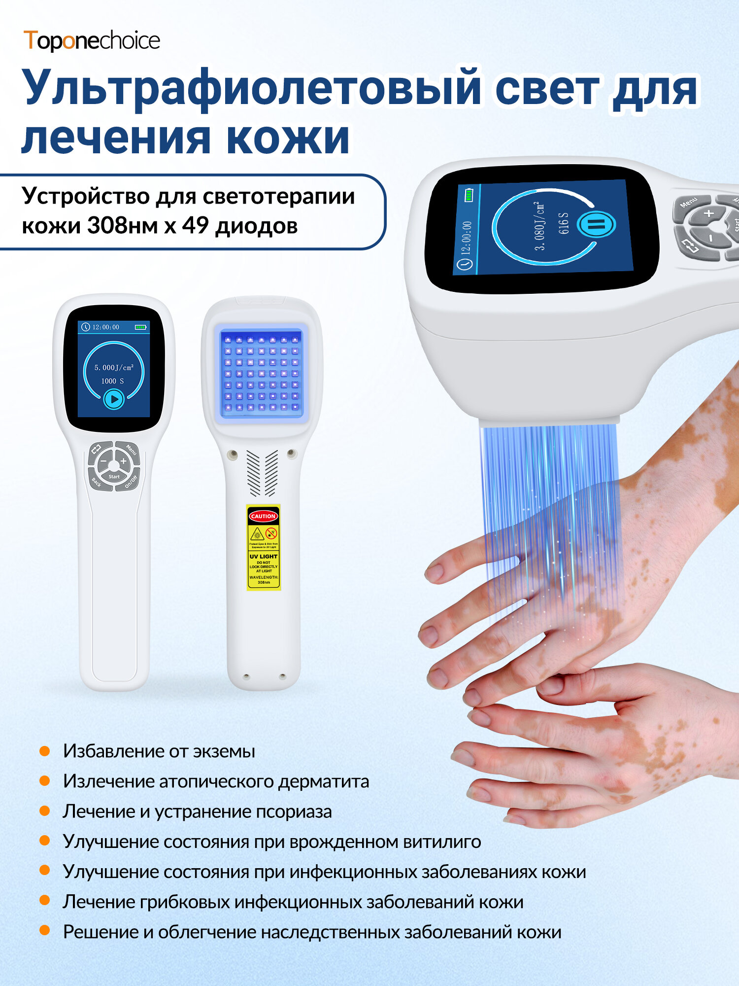 Toponechoice 308 нм эксимерная сине-ультрафиолетовая система для терапии пигментных нарушений и контактного дерматита