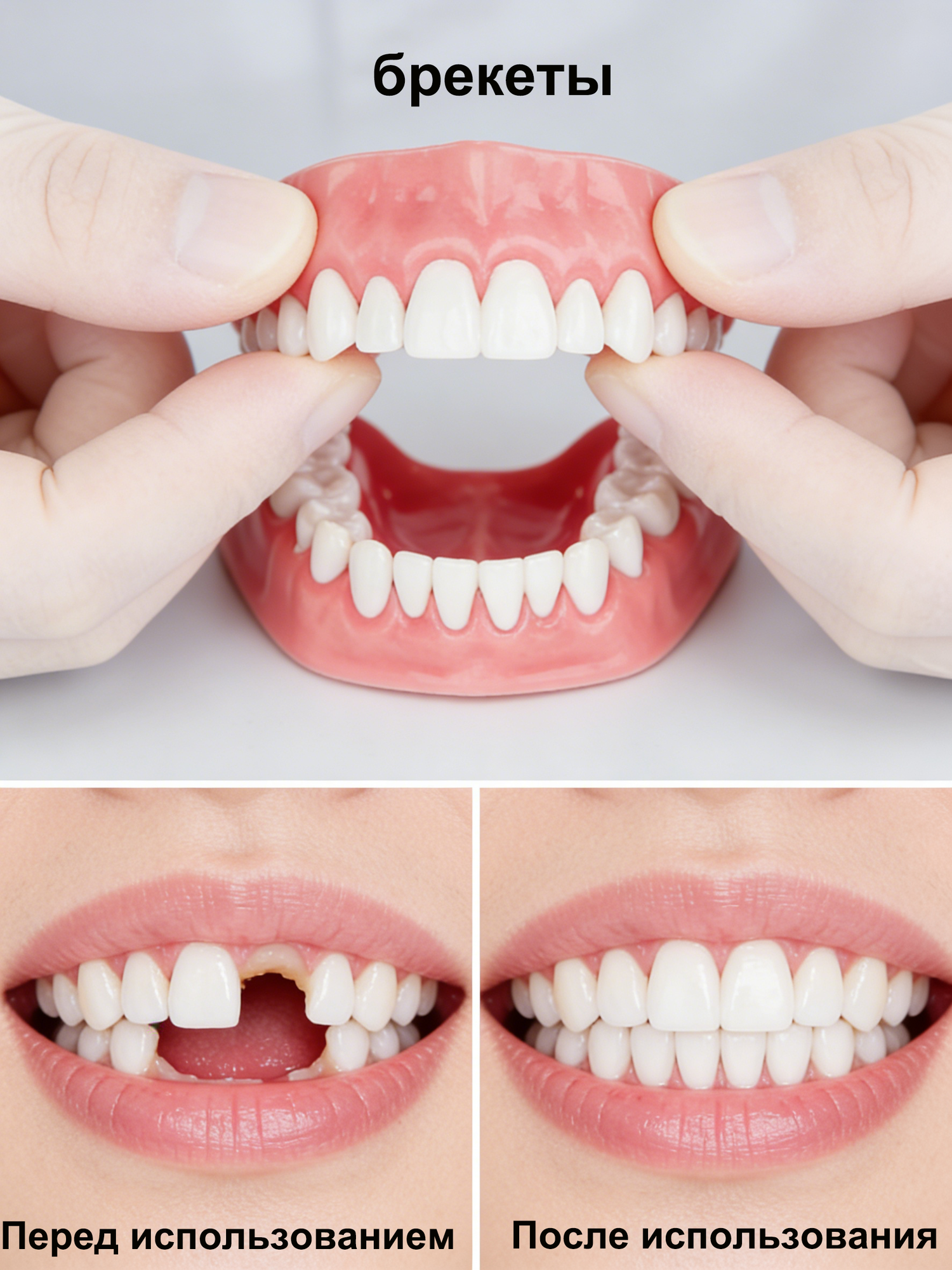 1 шт. временные зубные протезы, верхние косметические виниры, зубные протезы