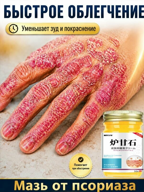 Негормональная мазь от псориаза, экземы, нейродермита и грибковых заболеваний, китайский крем от псориаза, 50 г.