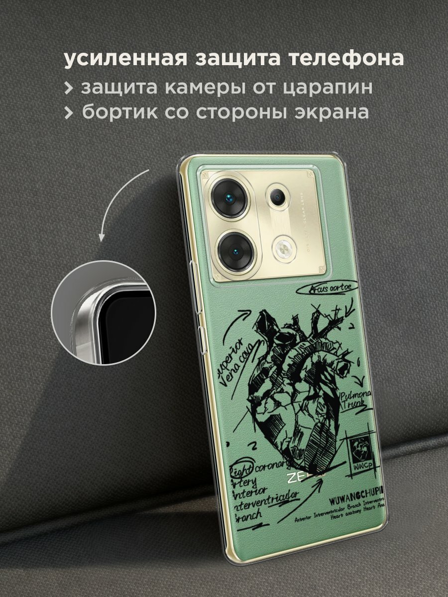 Чехол на Infinix Zero 30 5G / Инфиникс Зеро 30 5G с принтом "Анатомическое сердце 2", прозрачный — фото 1