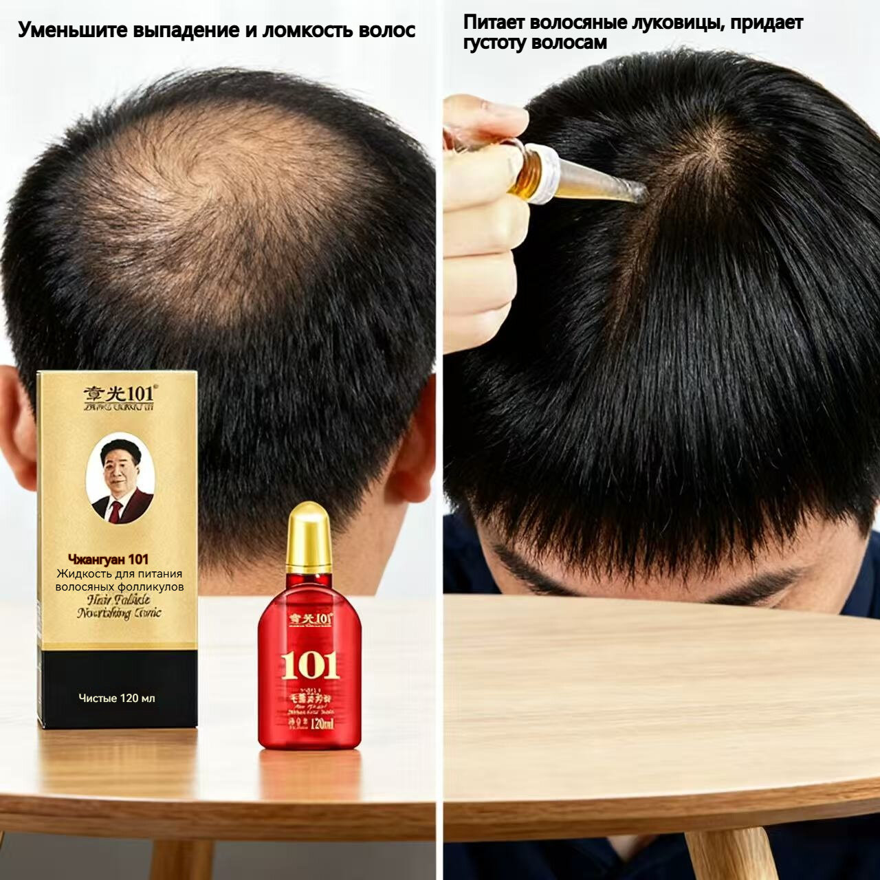 Zhangguang 101 Hair Follicle Nourishing Tonic лосьон для роста волос. 120 мл.
